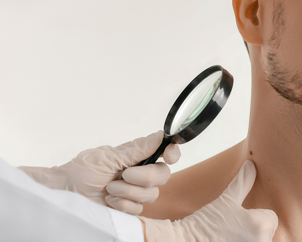 Mole Screening Service Benfleet , Aesthetics In Benfleet, Essex